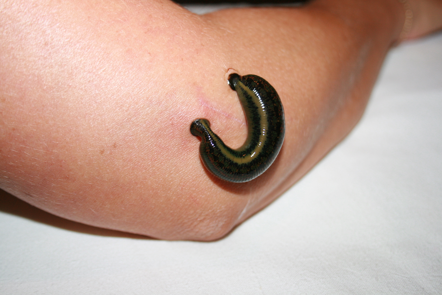 Blutegeltherapie | Tanja Mahlstede